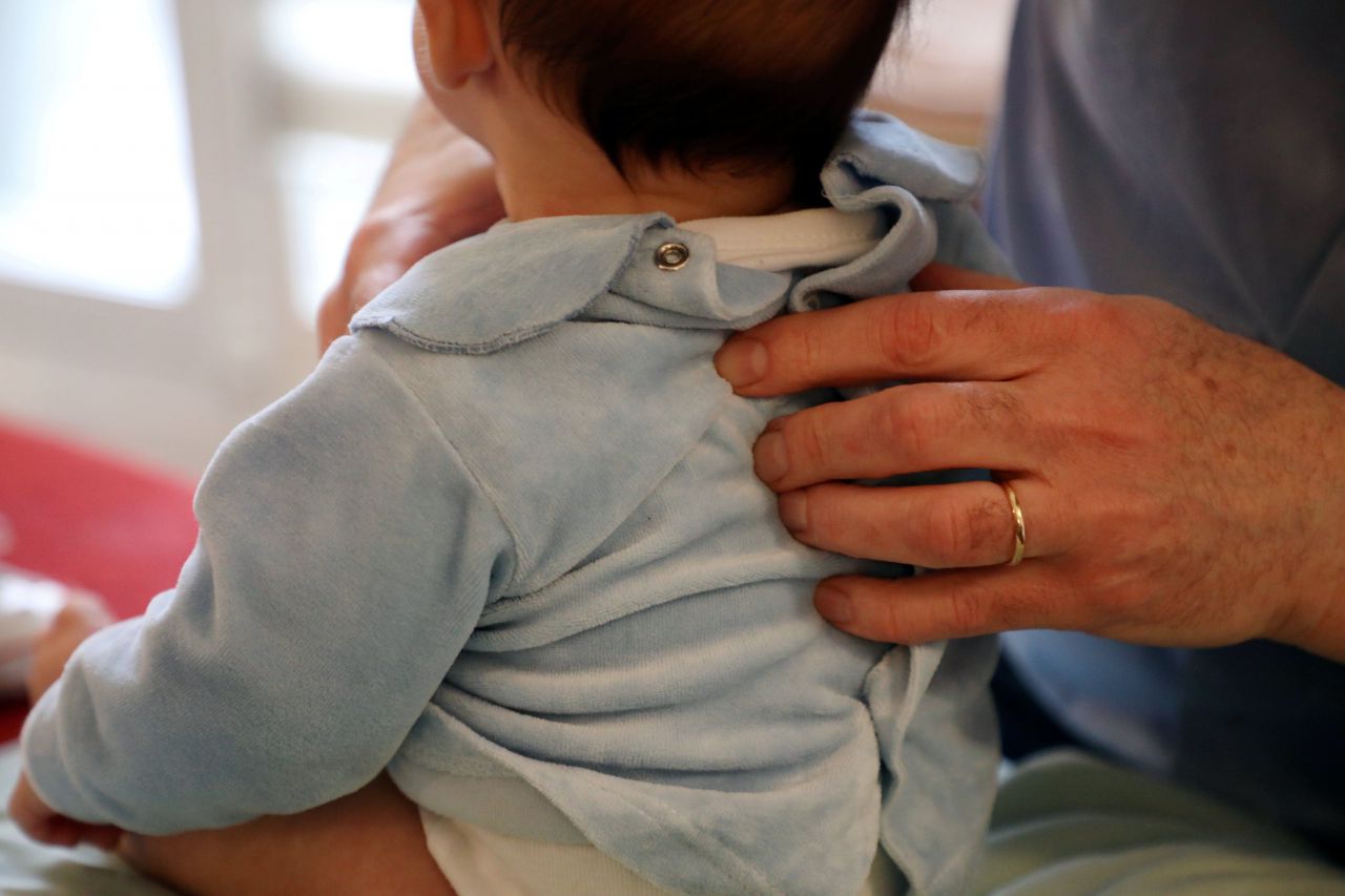 Une association alerte face à «l'épidémie» de têtes plates chez les ...